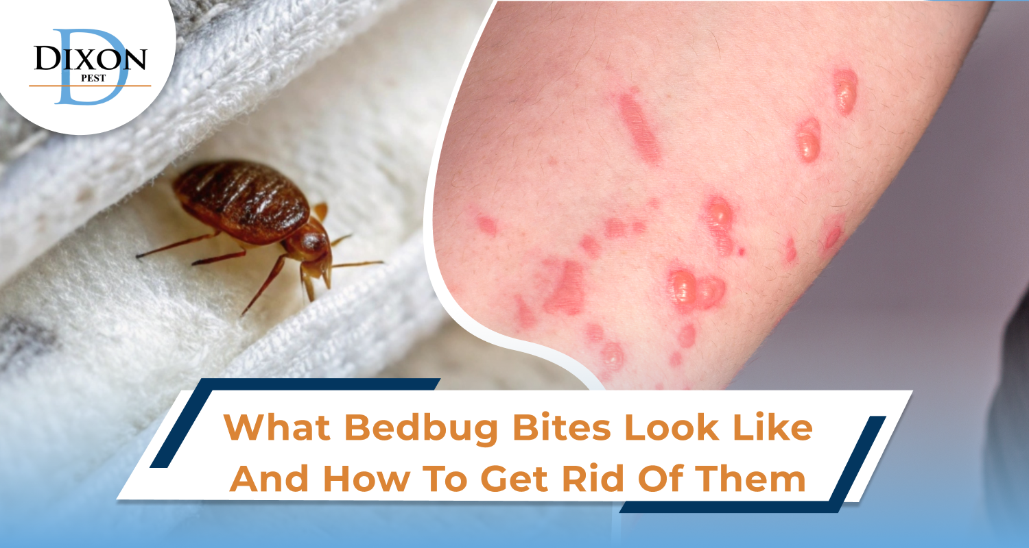 Bed Bug Treatments: Identify Bites & Get Rid of Them