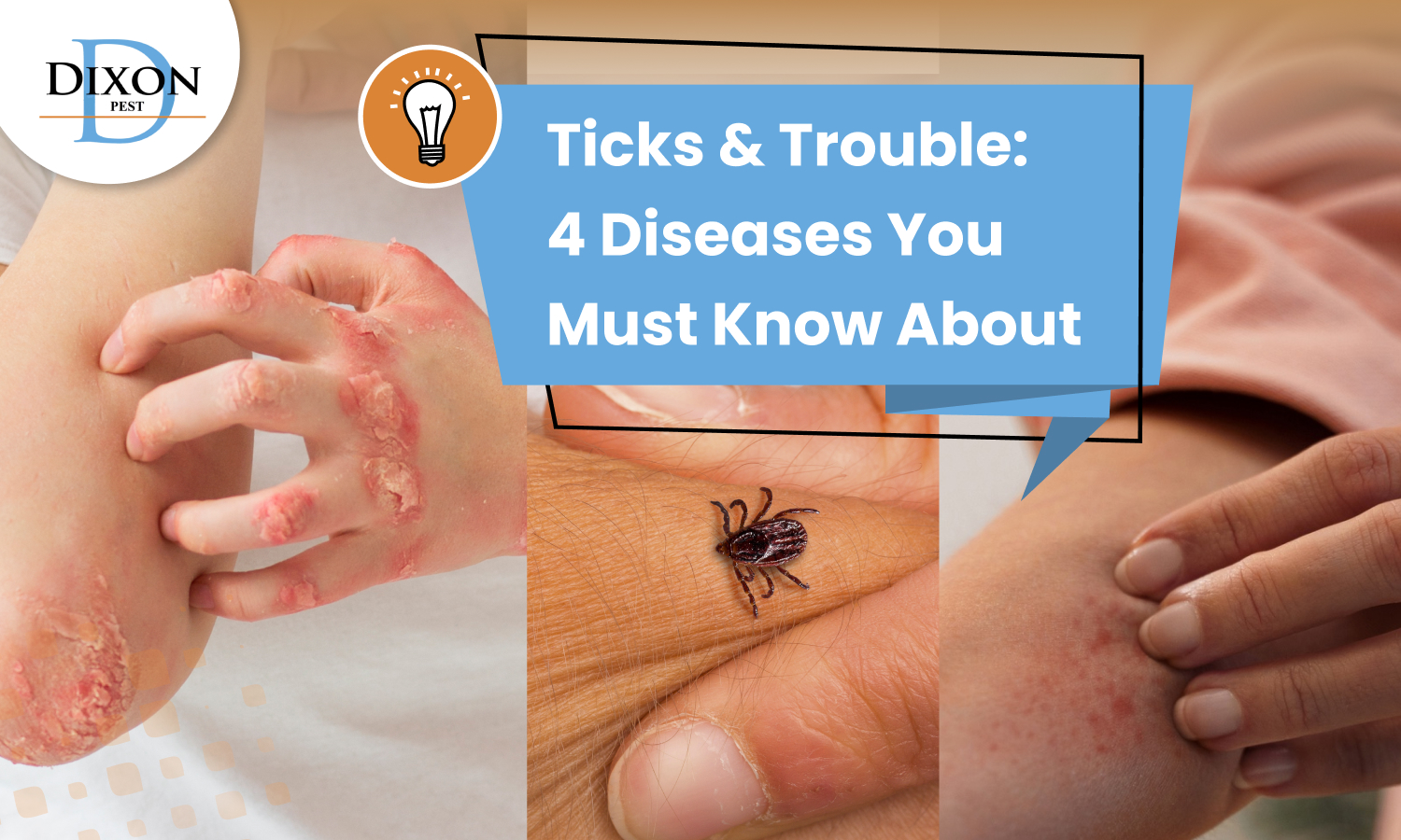 Ticks & Trouble: Tick-Borne Diseases You Should Know